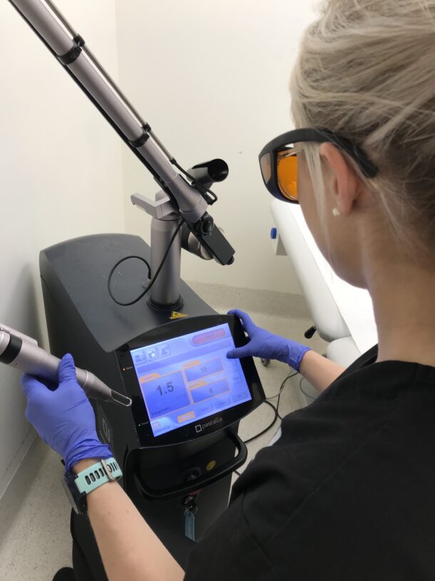 QSwitch Laser - Skinfluence Clinic